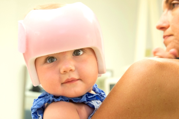 Help! My Baby Has a Flat Head! - Stay at Home Mum